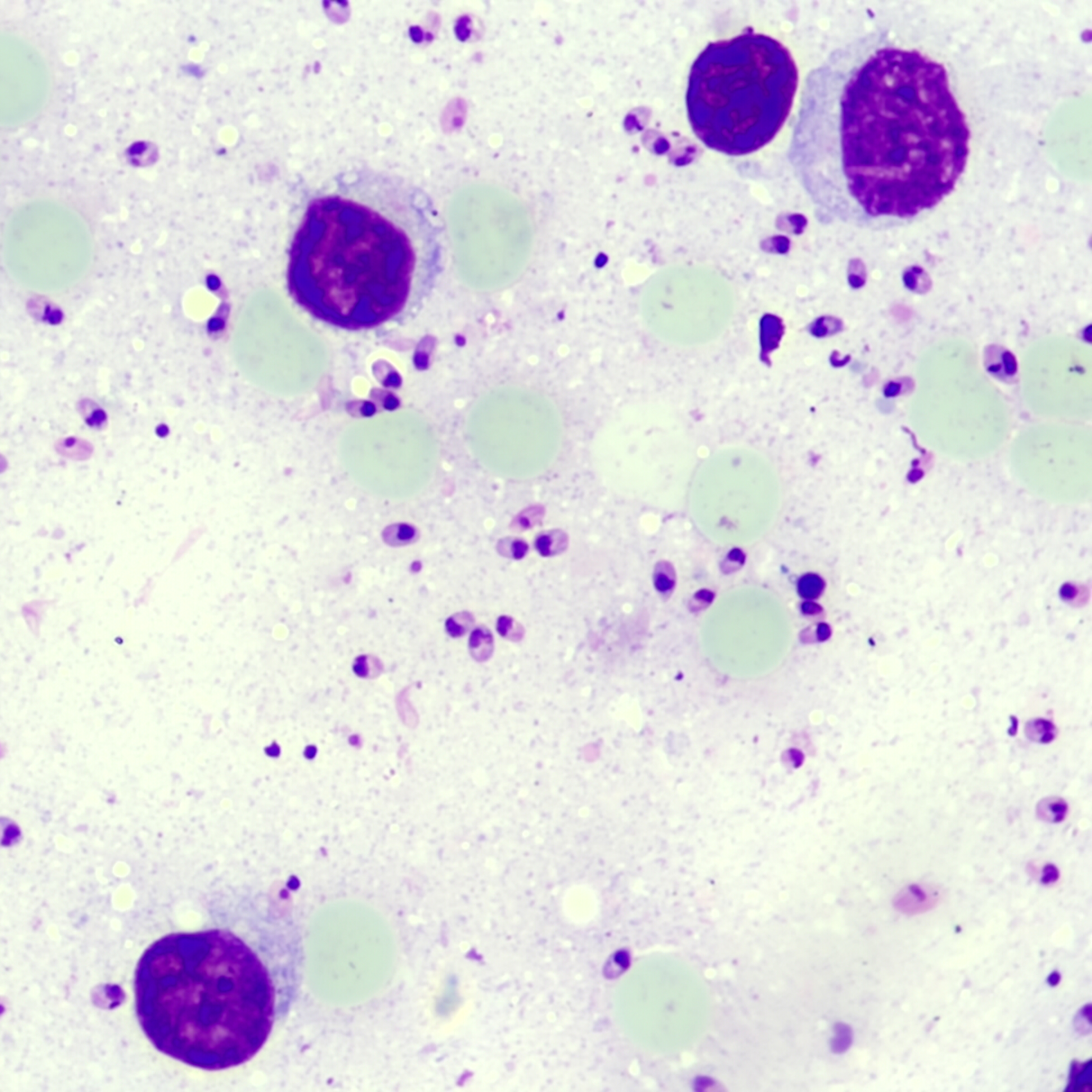 🔬 Modelos de Detección - Documentación de Leishmaniapp